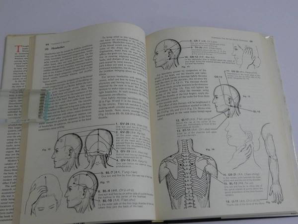 TSUBO 壷 Vital Points for Oriental Therapy by Katsusuke Serizawa 英文 / あんず古書店 / 古本、中古本、古書籍の通販は「日本の古本屋」